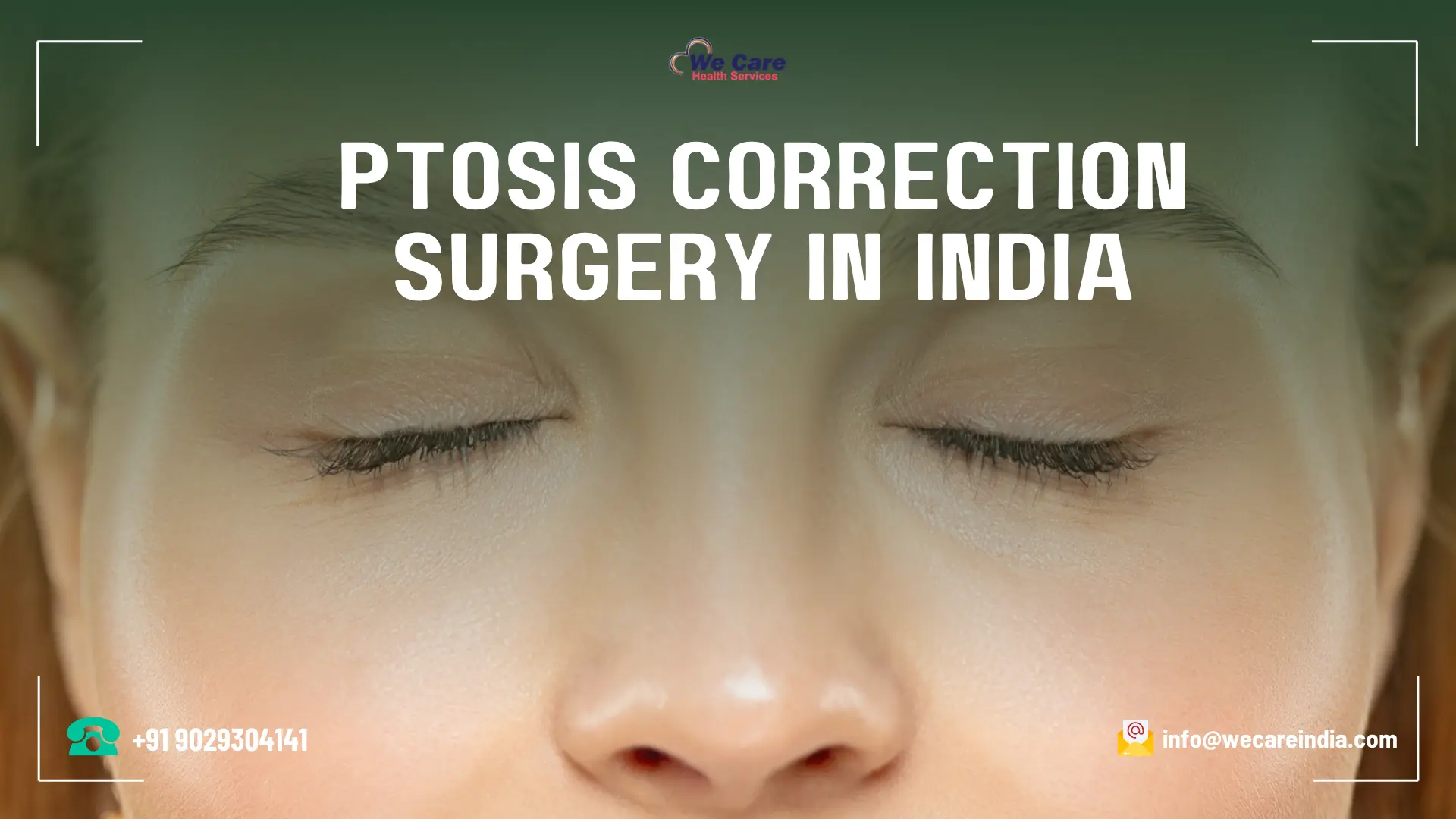 Ptosis Correction Surgery in India: Procedure, Recovery & Results