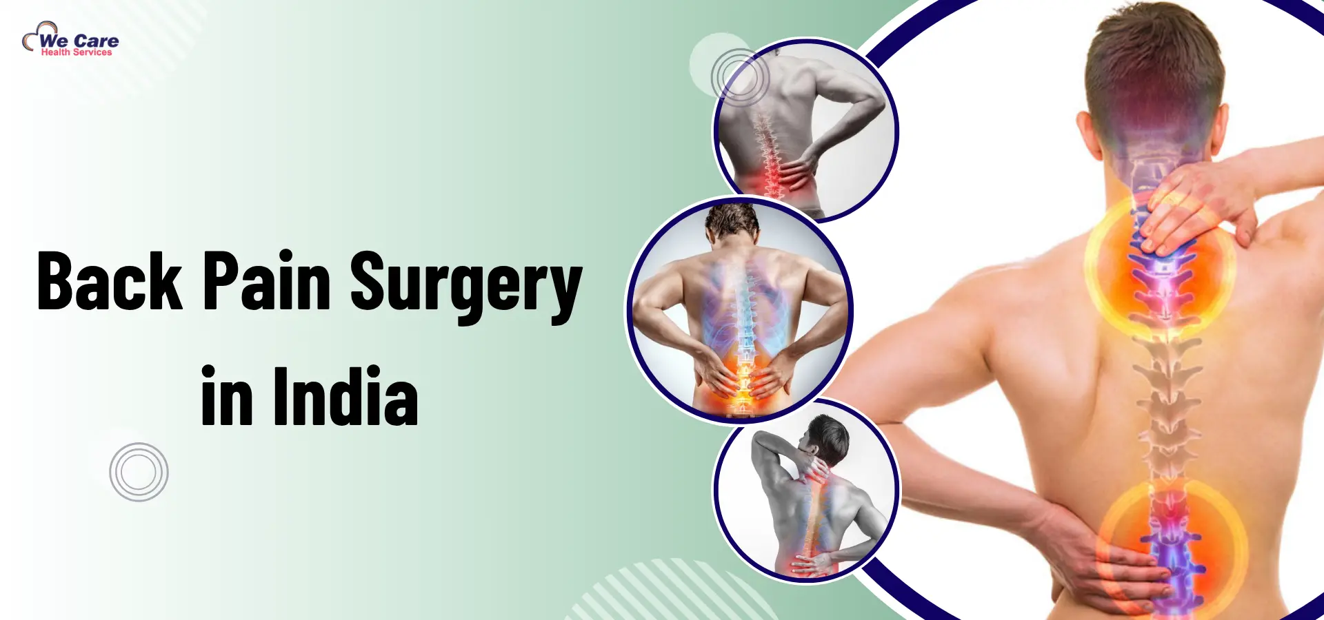 Best Hospitals for Back Pain Surgery in India